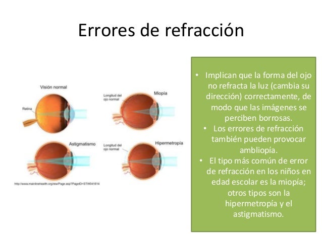 Problemasvision