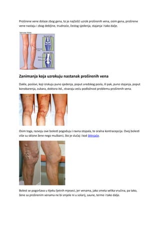 Problemi sa proširenim venama | PDF