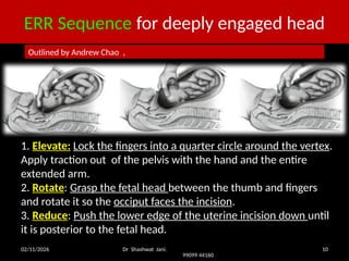 PROBLEM OF DELIVERING FETAL HEAD DURING CESAREAN SECTION BY DR SHASHWAT ...