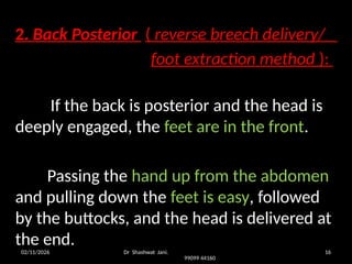 PROBLEM OF DELIVERING FETAL HEAD DURING CESAREAN SECTION BY DR SHASHWAT ...