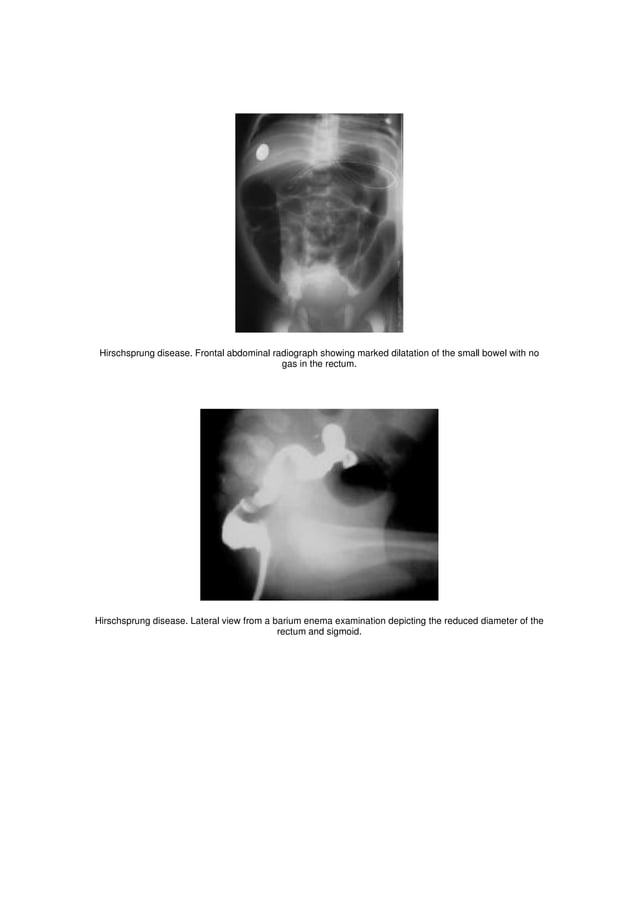 Problem Oriented Approach In Pediatric Radiology Pdf