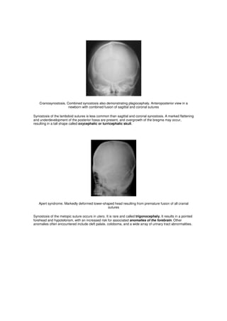 Problem oriented approach in pediatric radiology | PDF