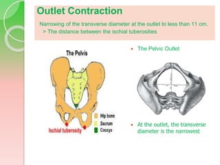 Problems-with-the-passage.pptx
