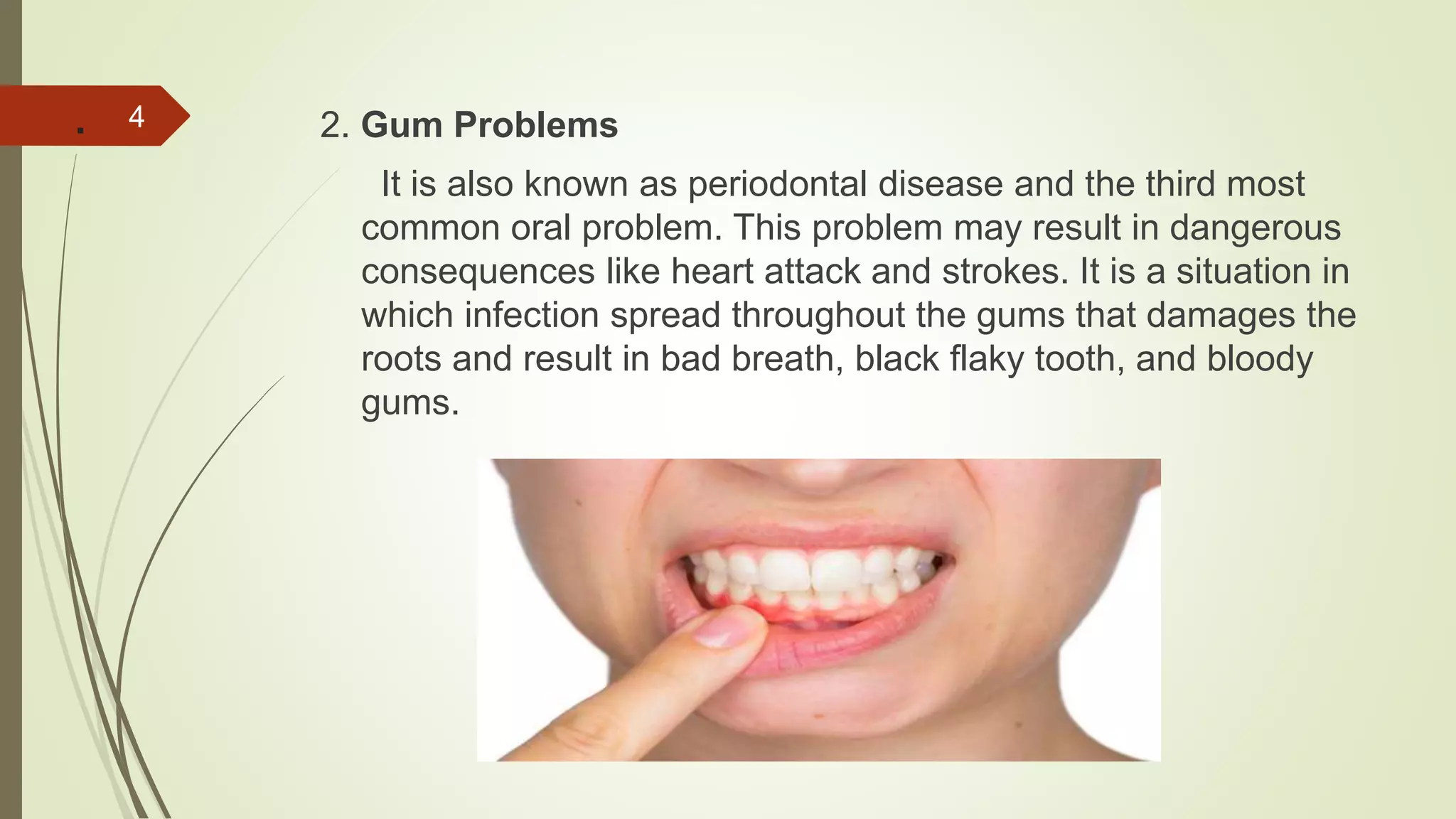 Problems associated with oral cavity | PPTX