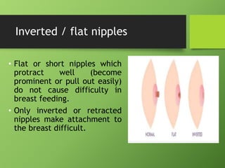 Problems in breastfeeding | PPTX