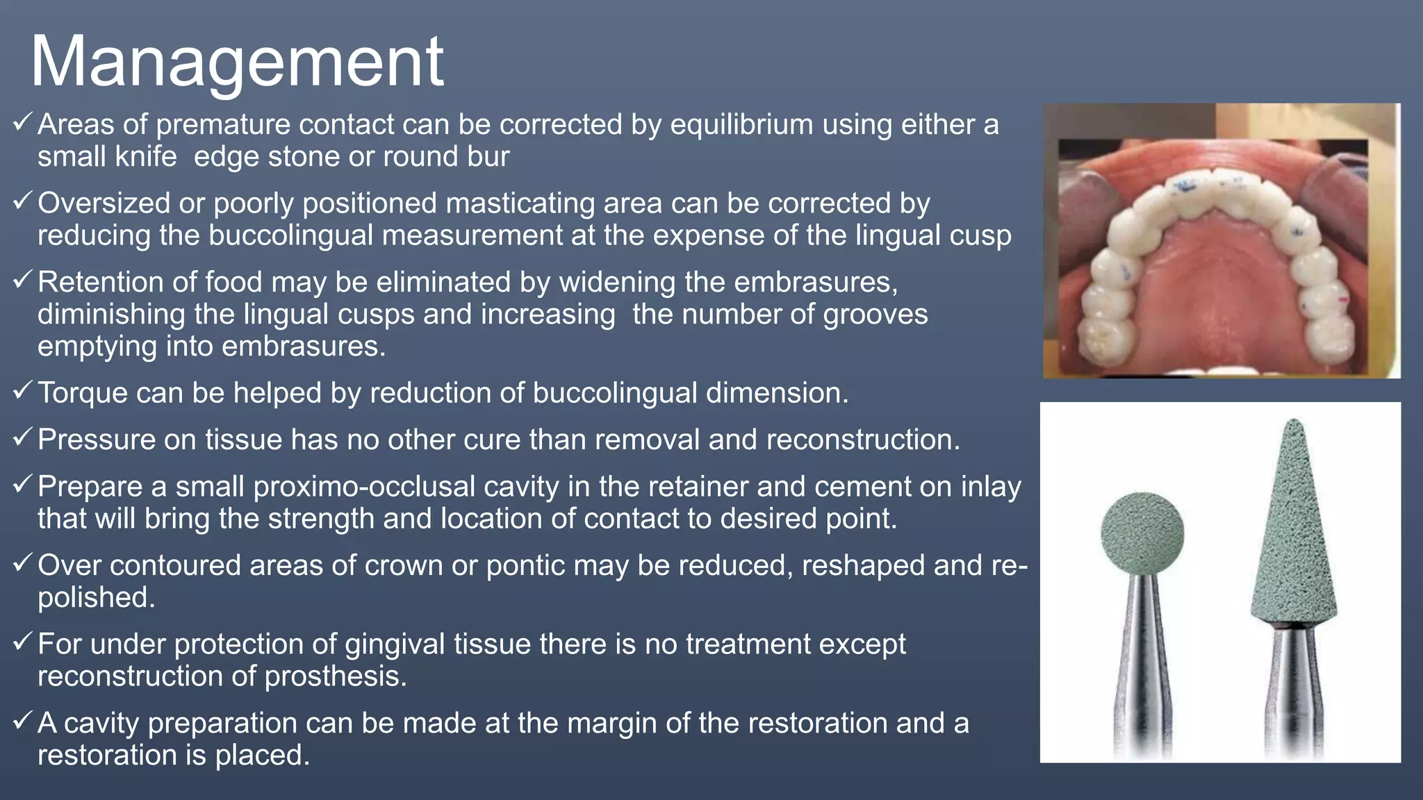 Failures in Fixed Partial Denture | PPTX