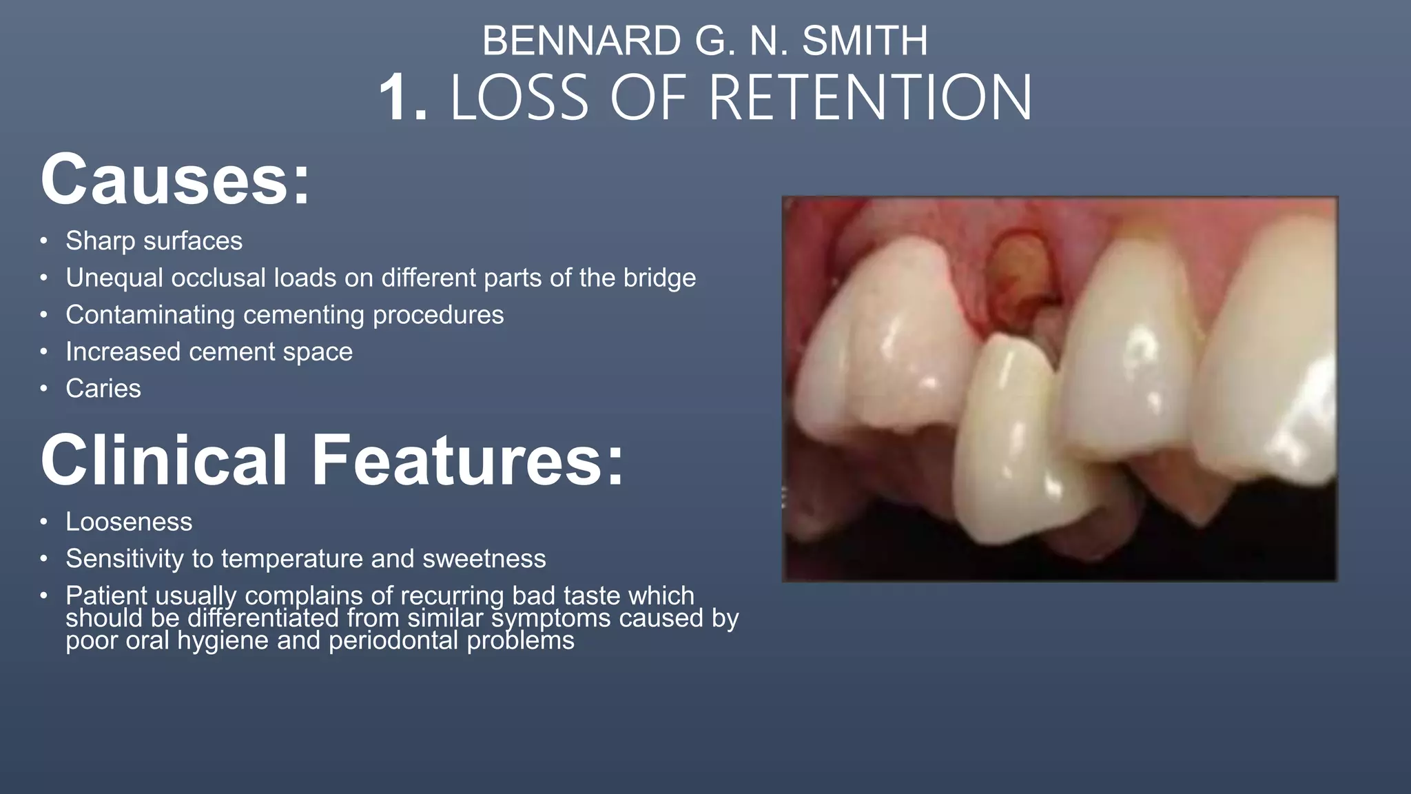 Failures in Fixed Partial Denture | PPTX