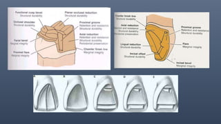 Failures in Fixed Partial Denture | PPTX