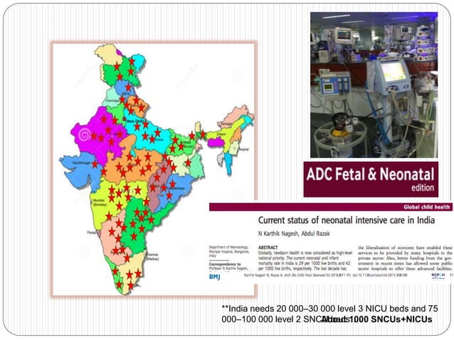 Problems in late preterm babies, iap bps,bangalore,webinar, 20-5-20 ...
