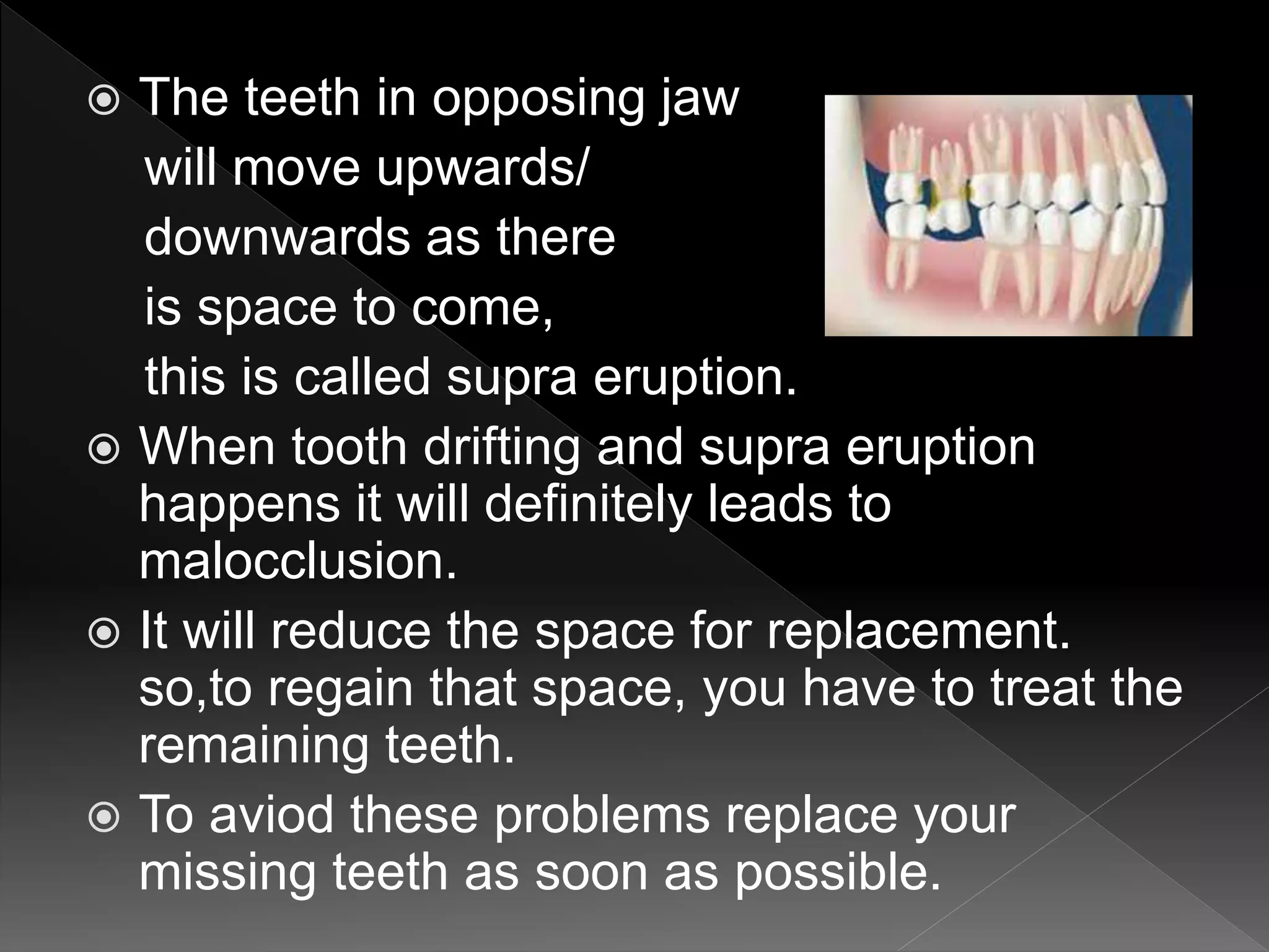 Problems in missing teeth | PPT