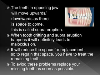 Problems in missing teeth | PPTX