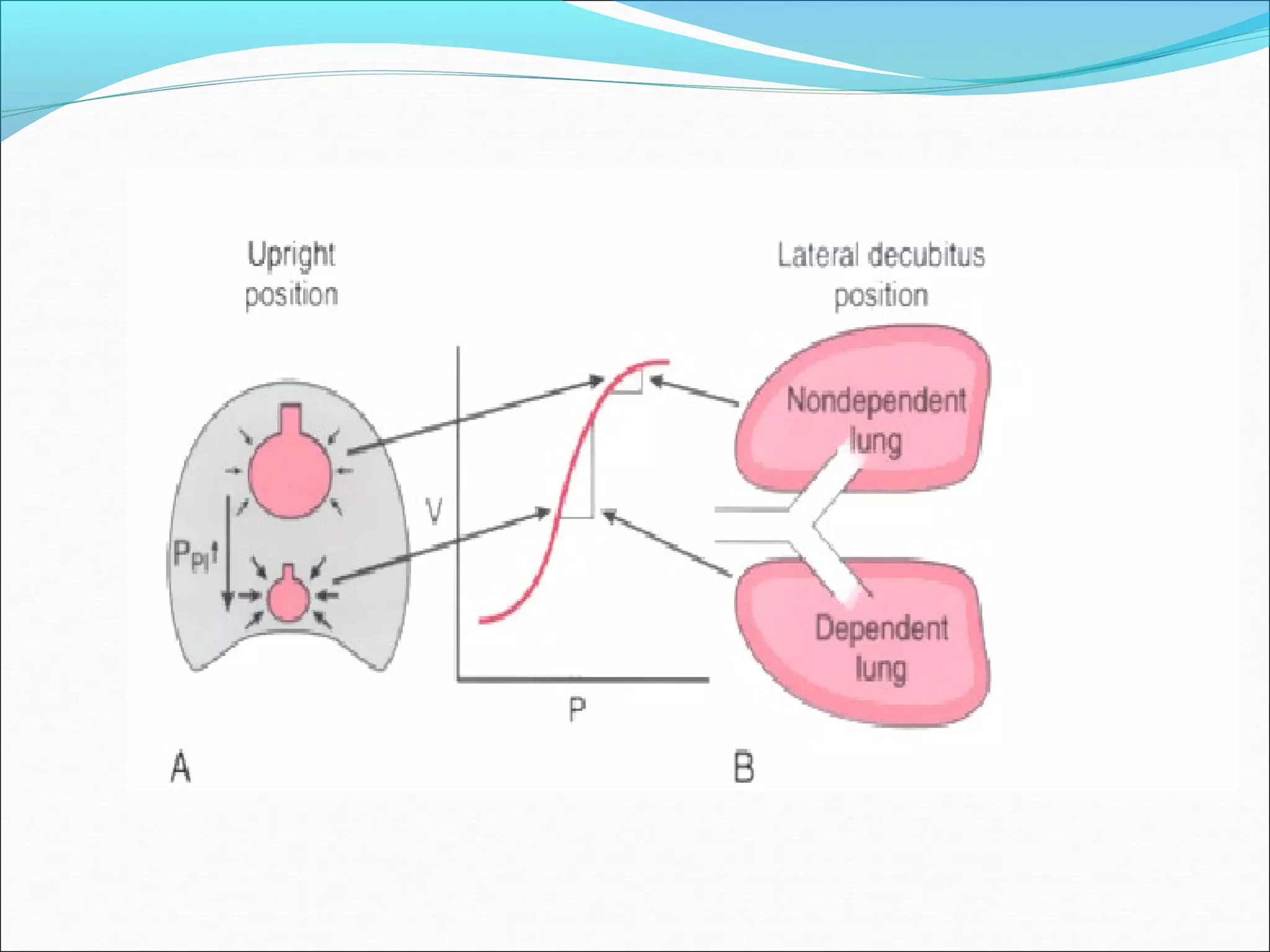 Anaesthetic problems of open chest and pathophysiology of one lung ...