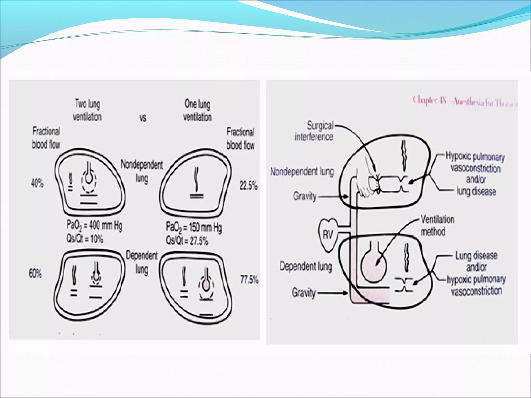 Anaesthetic problems of open chest and pathophysiology of one lung ...
