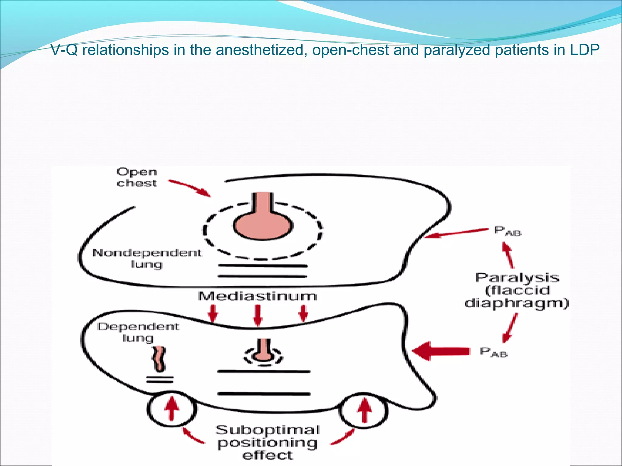Anaesthetic problems of open chest and pathophysiology of one lung ...