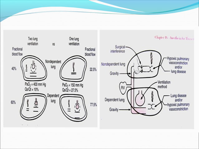 Anaesthetic problems of open chest and pathophysiology of one lung ...