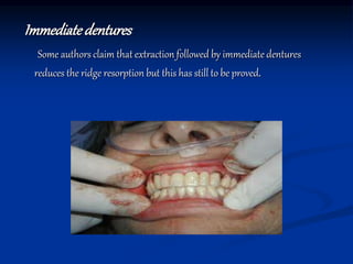 problems of residual alveolar ridge.ppt