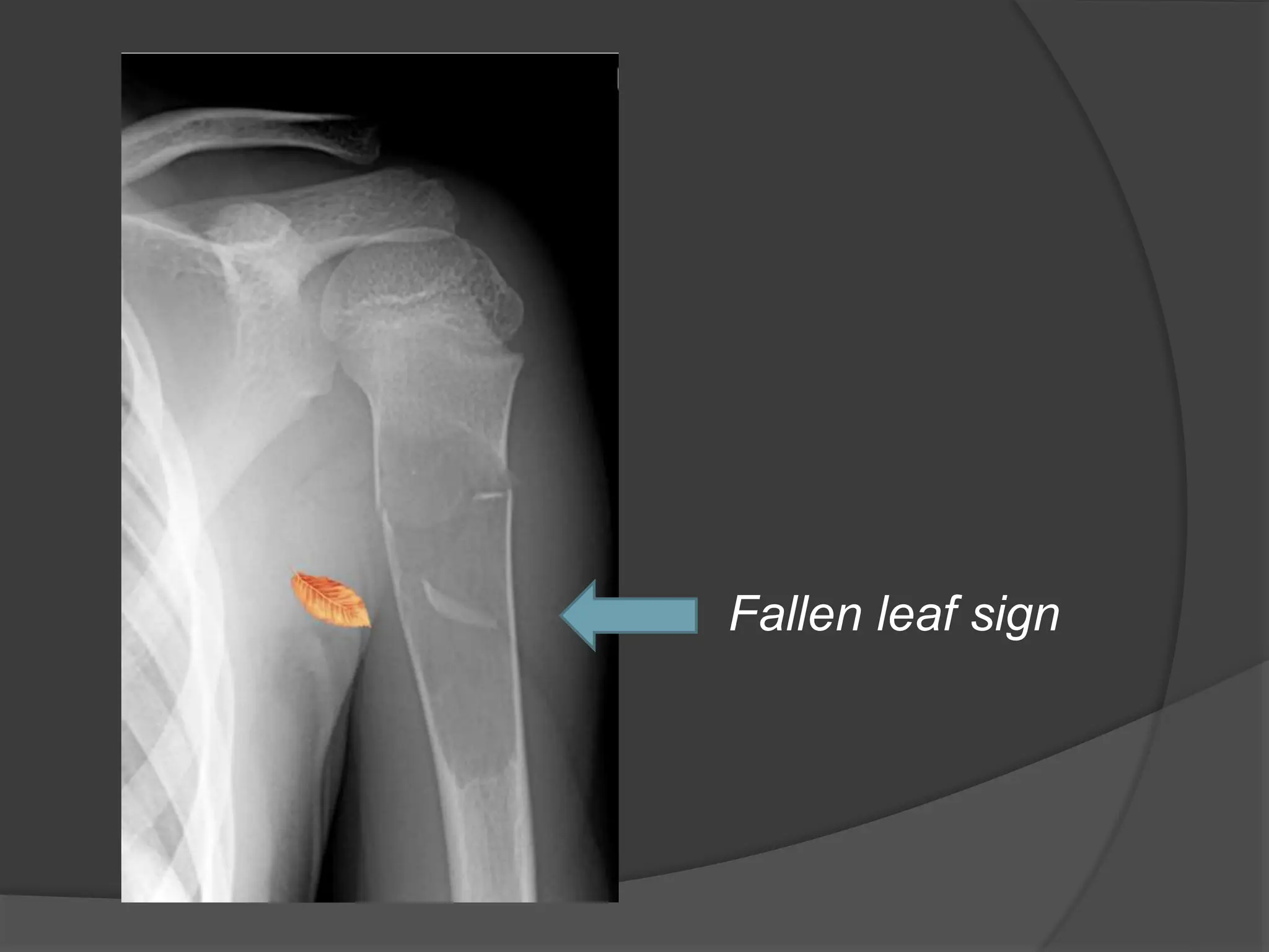 Problem solving : a quiz in general surgerypptx | PPTX