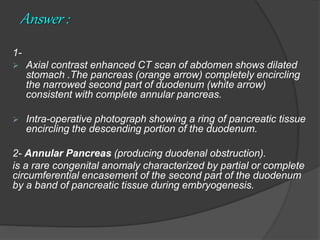 Problem solving : a quiz in general surgery .pptx
