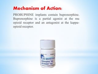 Probuphine | PPT