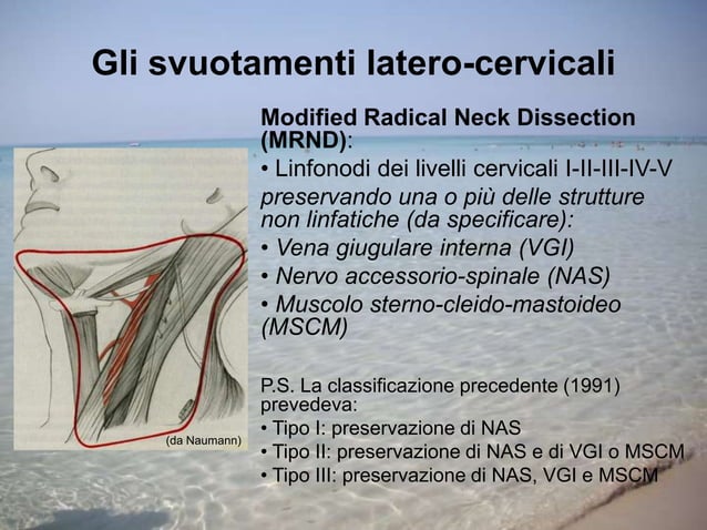 Indicazioni agli svuotamenti linfonodali del collo | PPTX