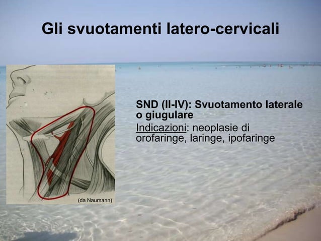 Indicazioni agli svuotamenti linfonodali del collo | PPTX