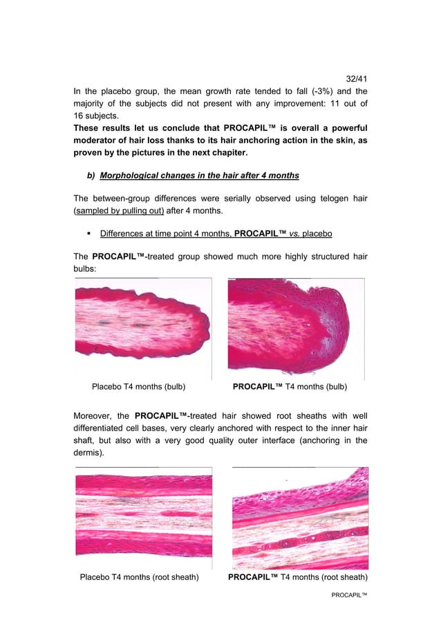 Estudios científicos de Procapil™ | PDF