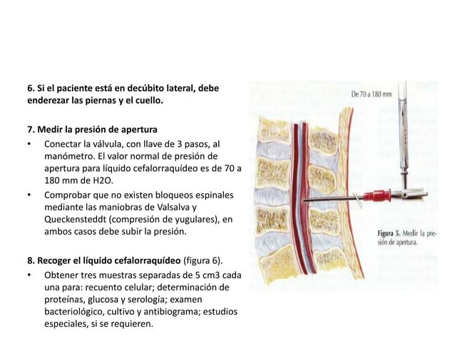 ¿cuáles son las complicaciones más comunes de la punción lumbar ...