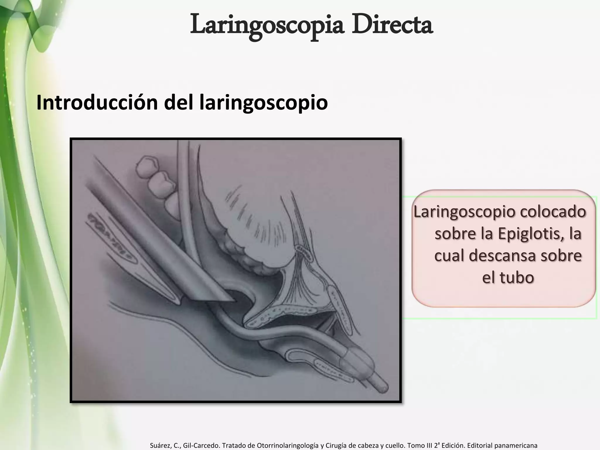 Procedimientos diagnosticos en laringe | PPTX