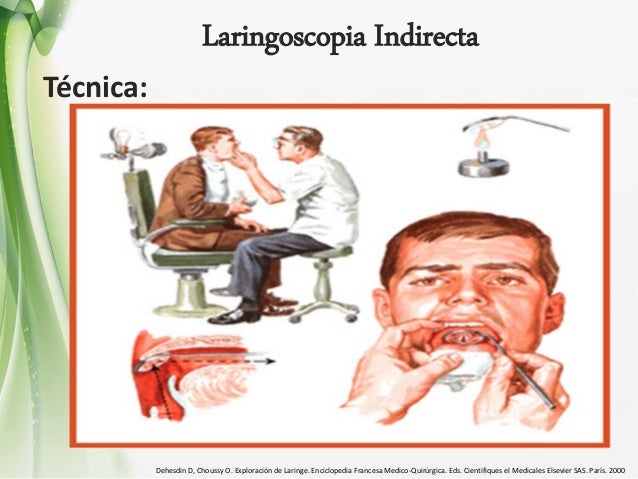Procedimientos diagnosticos en laringe