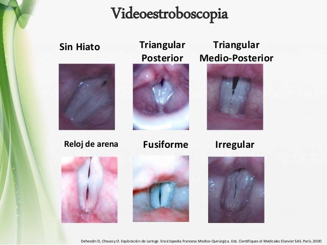 Procedimientos diagnosticos en laringe