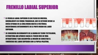 Procedimientos quirúrgicos en odontología infantil | PPTX
