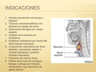 Procedimientos quirurgicos basicos | PPTX