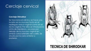 Procedimientos quirurgicos en cervix uterino | PPTX