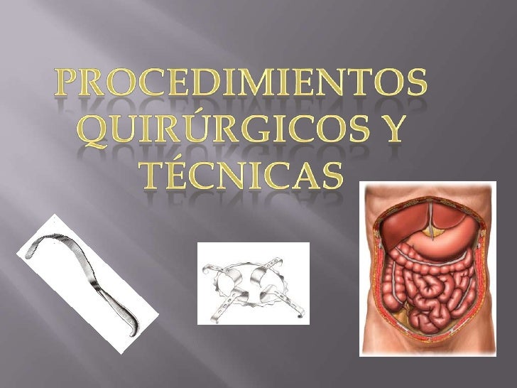 Procedimientos quirurgicos y tecnicas Procedimientos quirurgicos y tecnicas