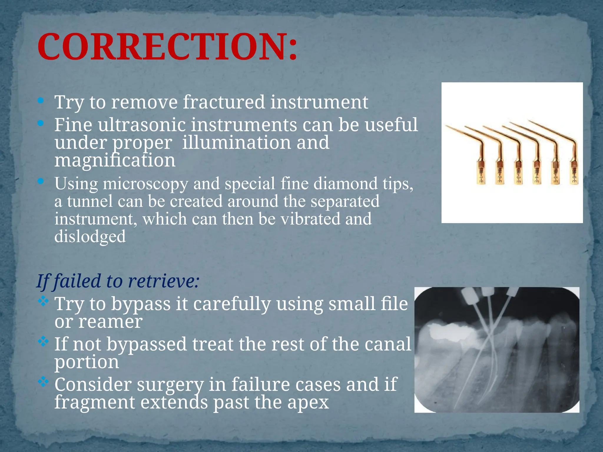 procedural errors diagnosis and treatment | PPT