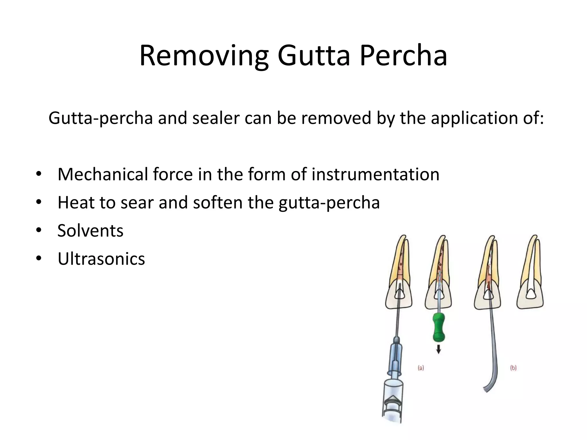 Procedural Errors in Biomecanical Preparation | PPTX