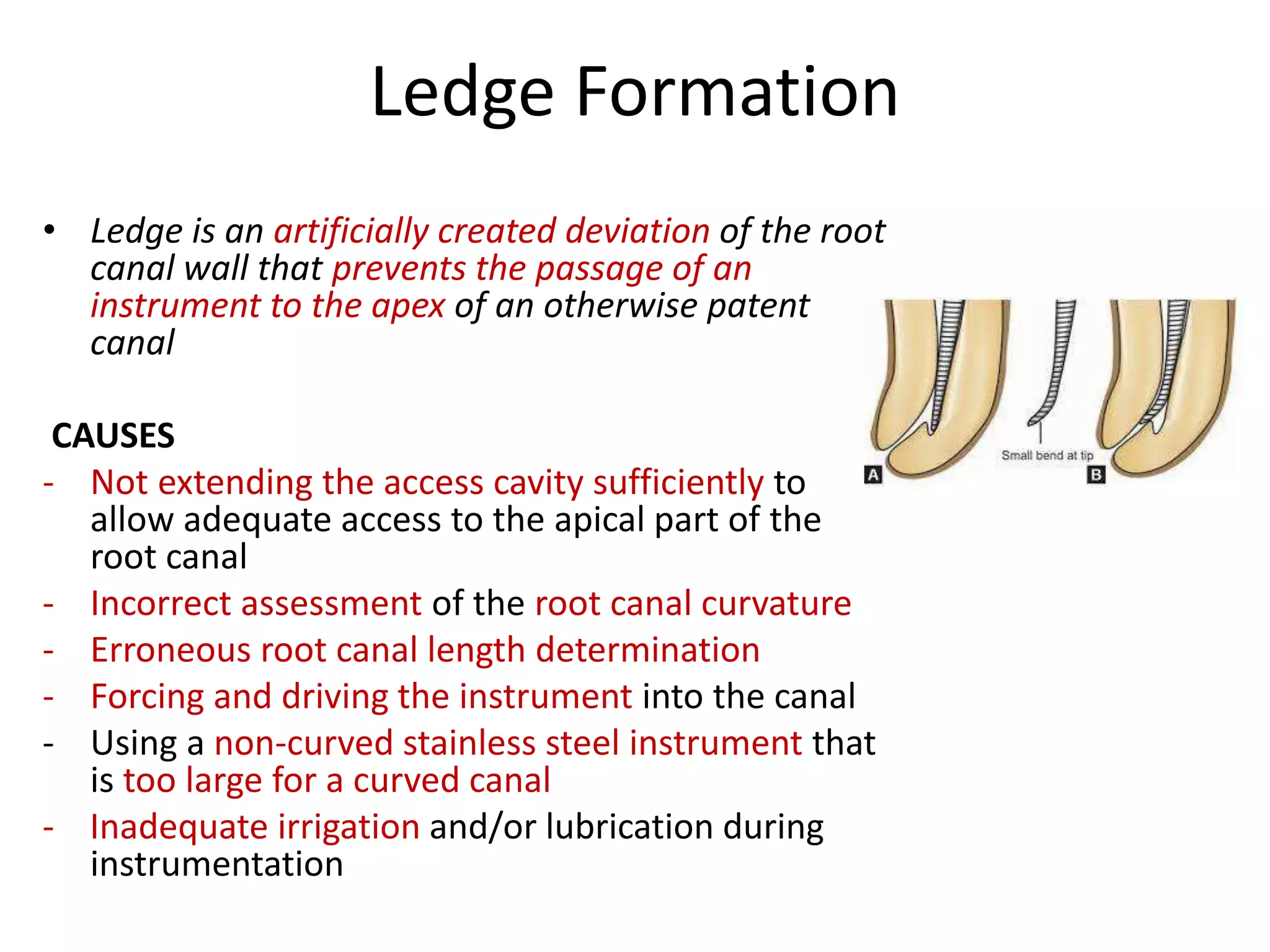 Procedural Errors in Biomecanical Preparation | PPTX