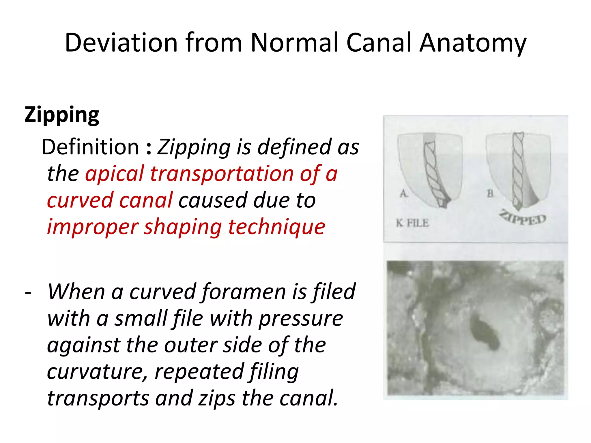 Procedural Errors in Biomecanical Preparation | PPTX