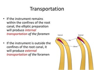 Procedural Errors in Biomecanical Preparation | PPTX