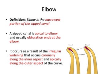 Procedural Errors in Biomecanical Preparation | PPTX