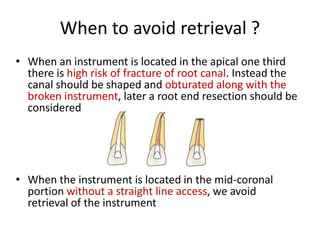 Procedural Errors in Biomecanical Preparation | PPTX