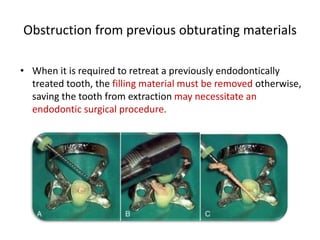 Procedural Errors in Biomecanical Preparation | PPTX