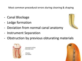 Procedural Errors in Biomecanical Preparation | PPTX