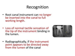 Procedural Errors in Biomecanical Preparation | PPTX