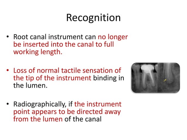 Procedural Errors in Biomecanical Preparation | PPTX