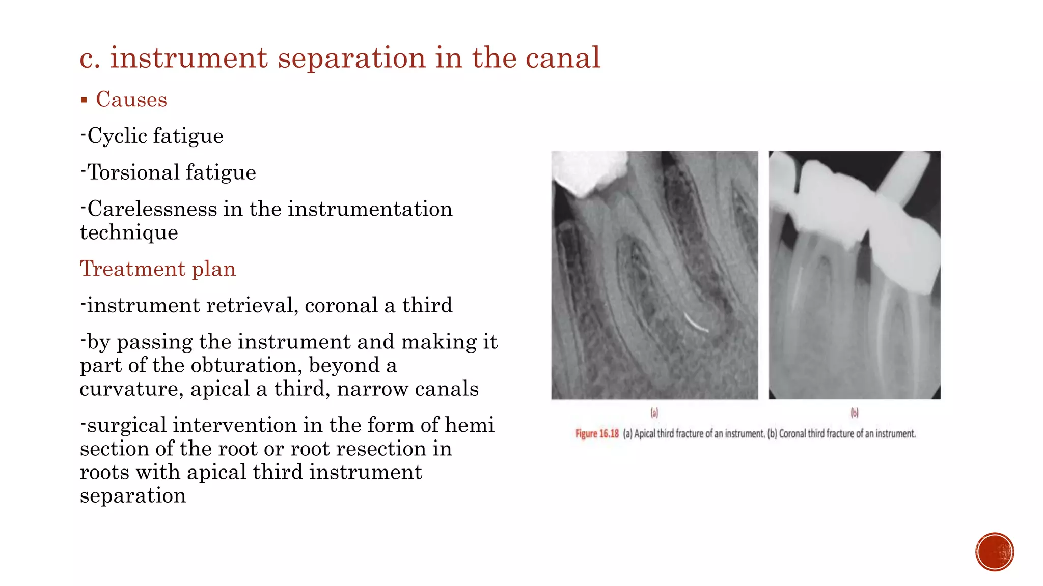 Procedural errors in endodontics | PPTX