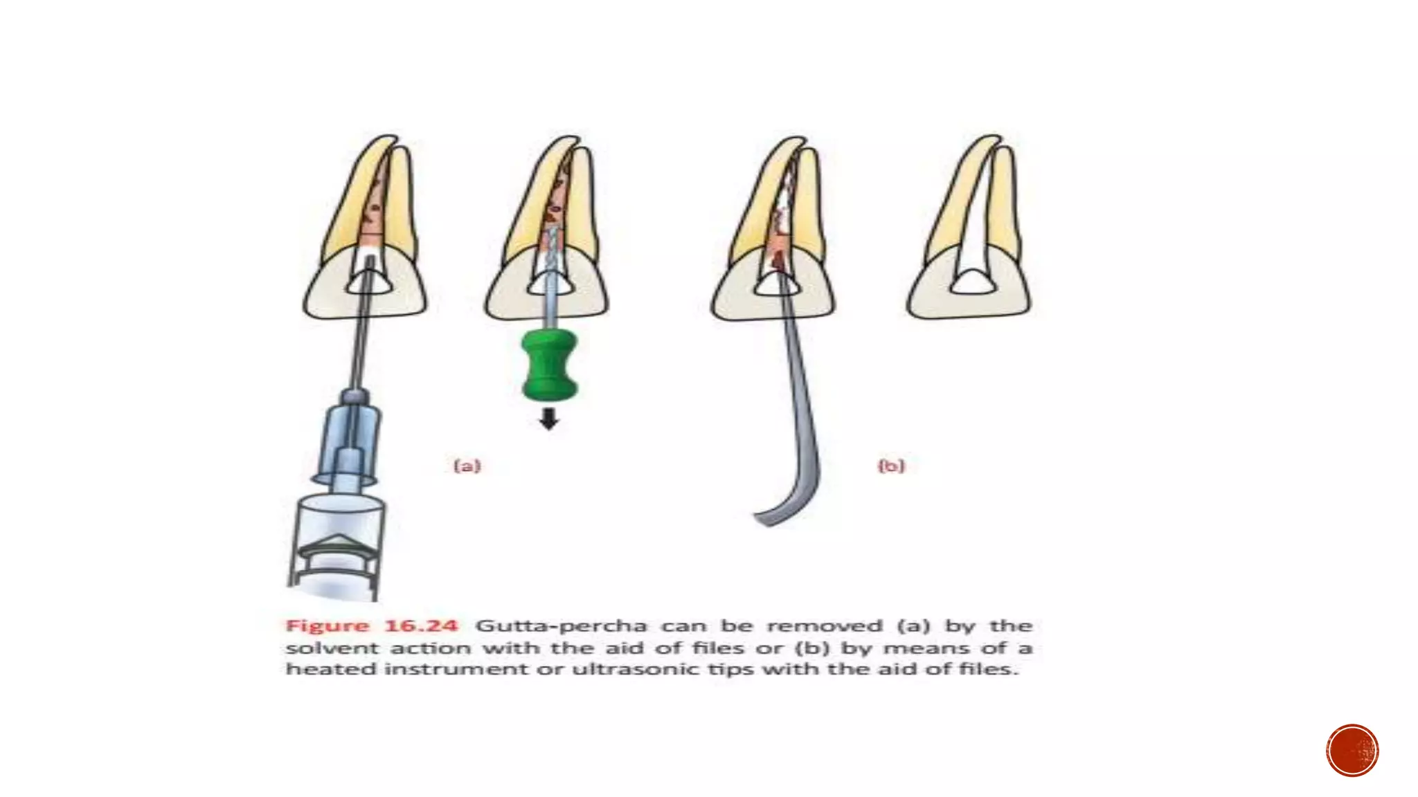 Procedural errors in endodontics | PPTX