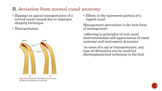 Procedural errors in endodontics | PPTX