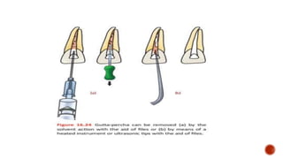 Procedural errors in endodontics | PPTX