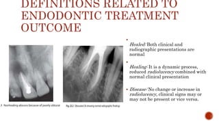 Procedural errors in endodontics | PPTX
